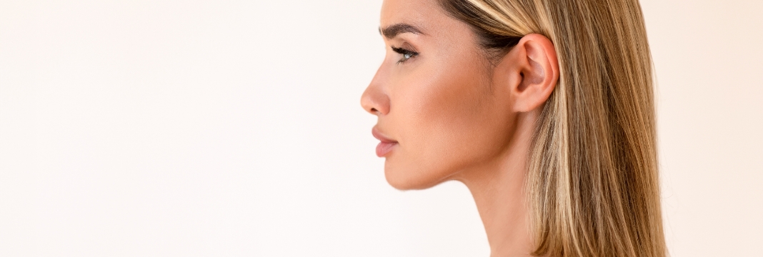 Kybella® — Redefine Your Profile - Sōna MedSpa